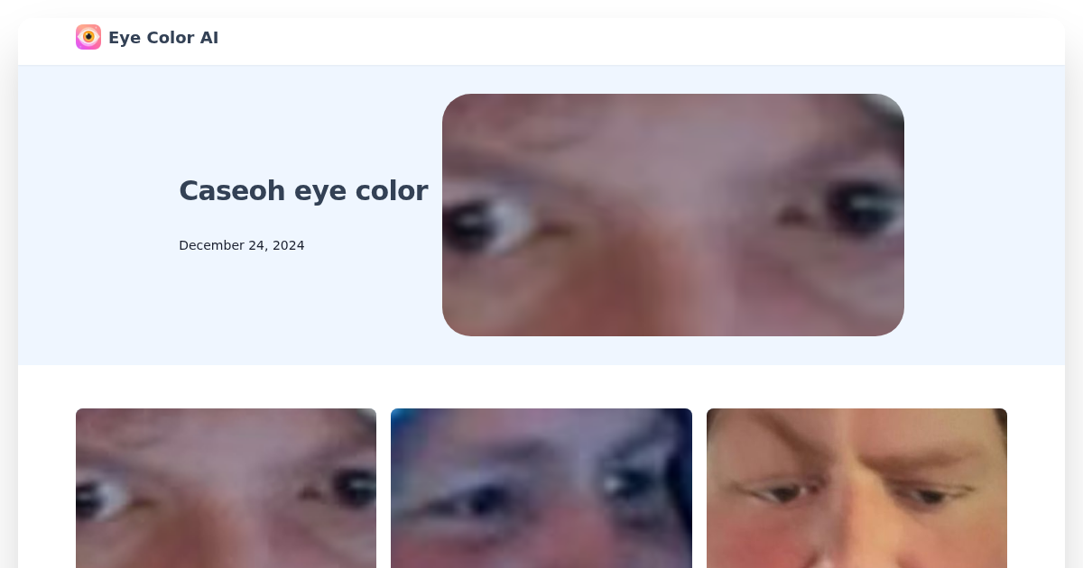 Caseoh eye color